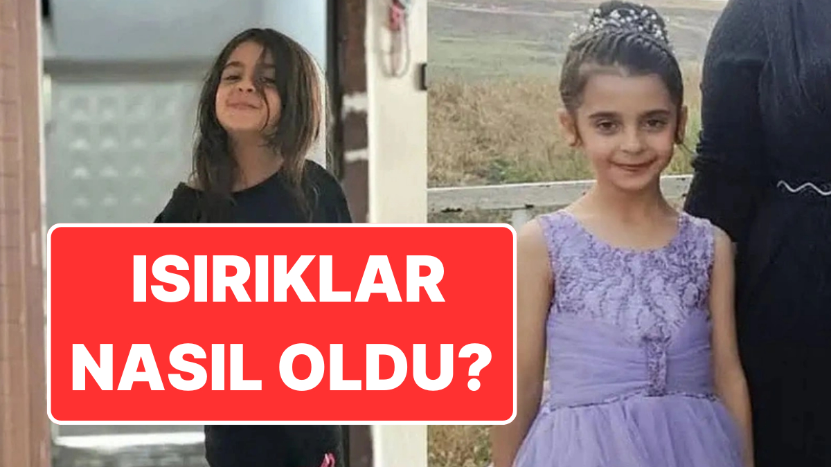 Kayıp Narin Güran’ın Gözaltındaki Abisinin Kolundaki Isırık İzleri fark ...